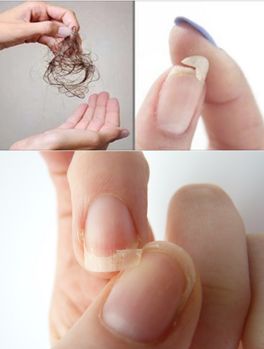 A home remedy that solves the problem of hair loss and brittle nails - Light Recipes