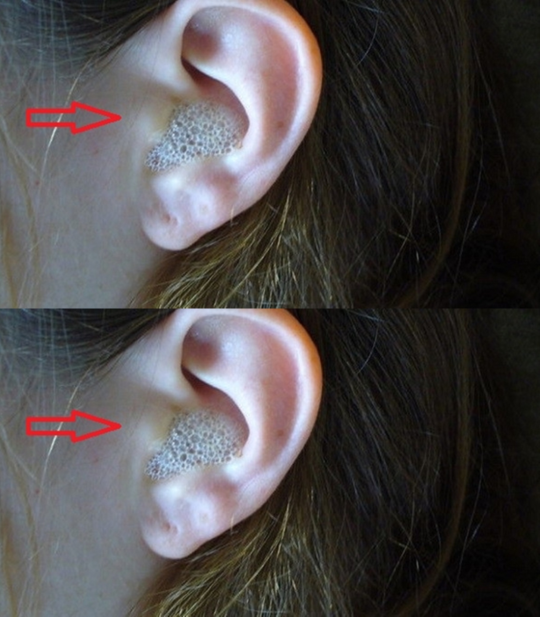 Just 3 drops clean the ear from clogging and dirt - Light Recipes