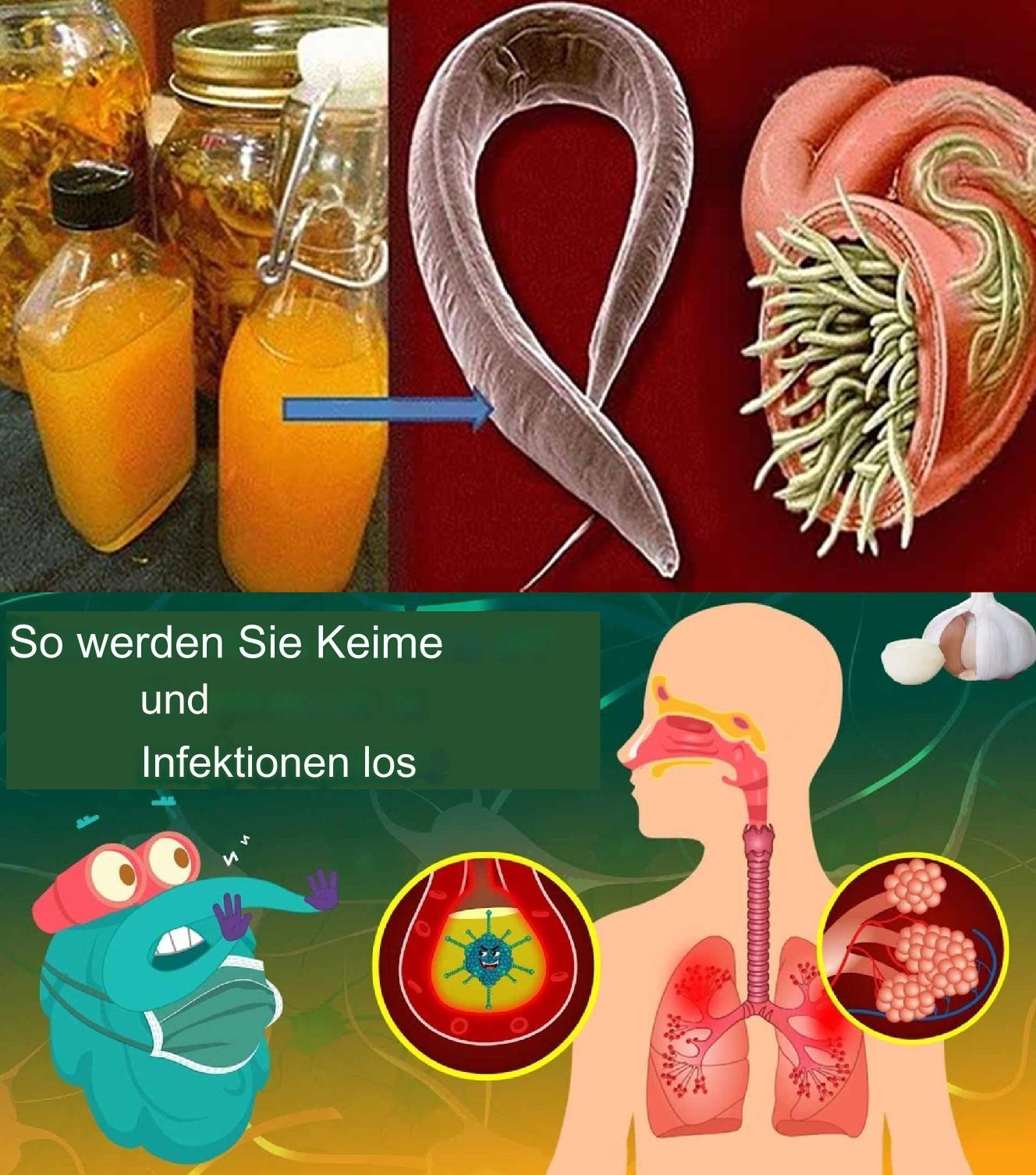 Get rid of germs and infections with this natural antibiotic - Light ...