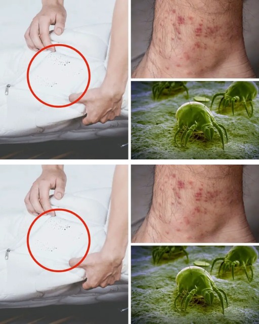 How to get rid of mites from our bed - Light Recipes